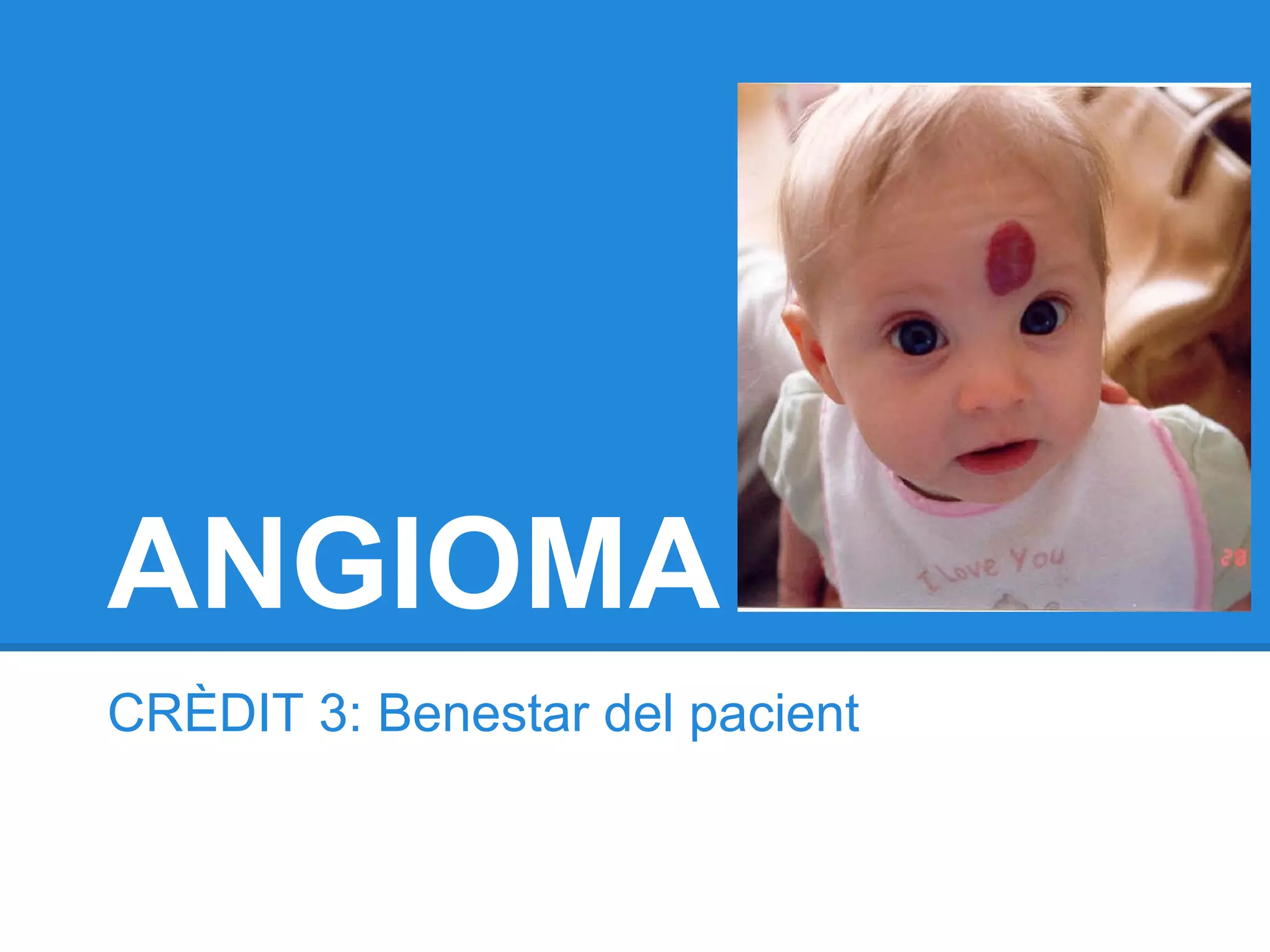 POWER POINT. ANGIOMA | PDF