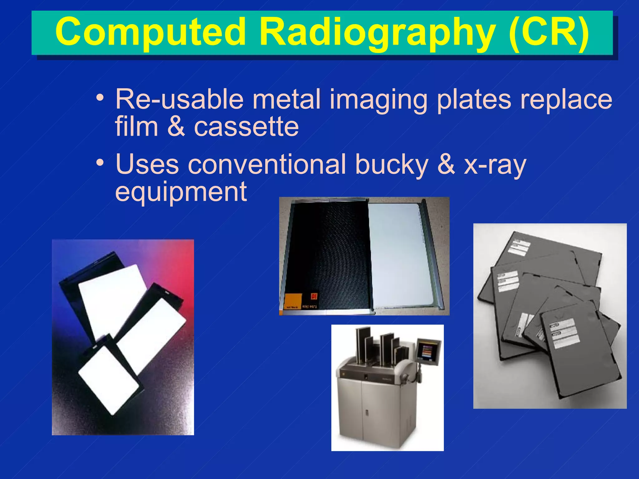 compiter radiography and digital radiography | PDF