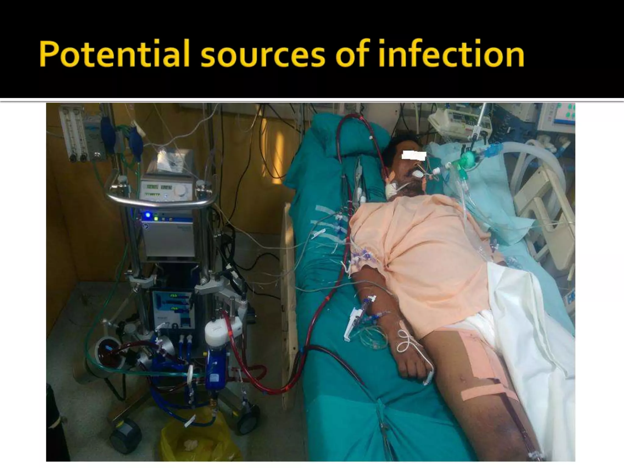 Managing MDR/XDR Gram Negative infections in ICU | PPTX