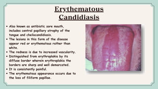 oral candidiasis from shafer's book of oral pathology | PDF