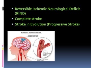konsep medis stroke nonhemoragik | PPT
