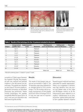 Creating papilla implant (dentalxp) by Stuart | PDF | Dental Health ...