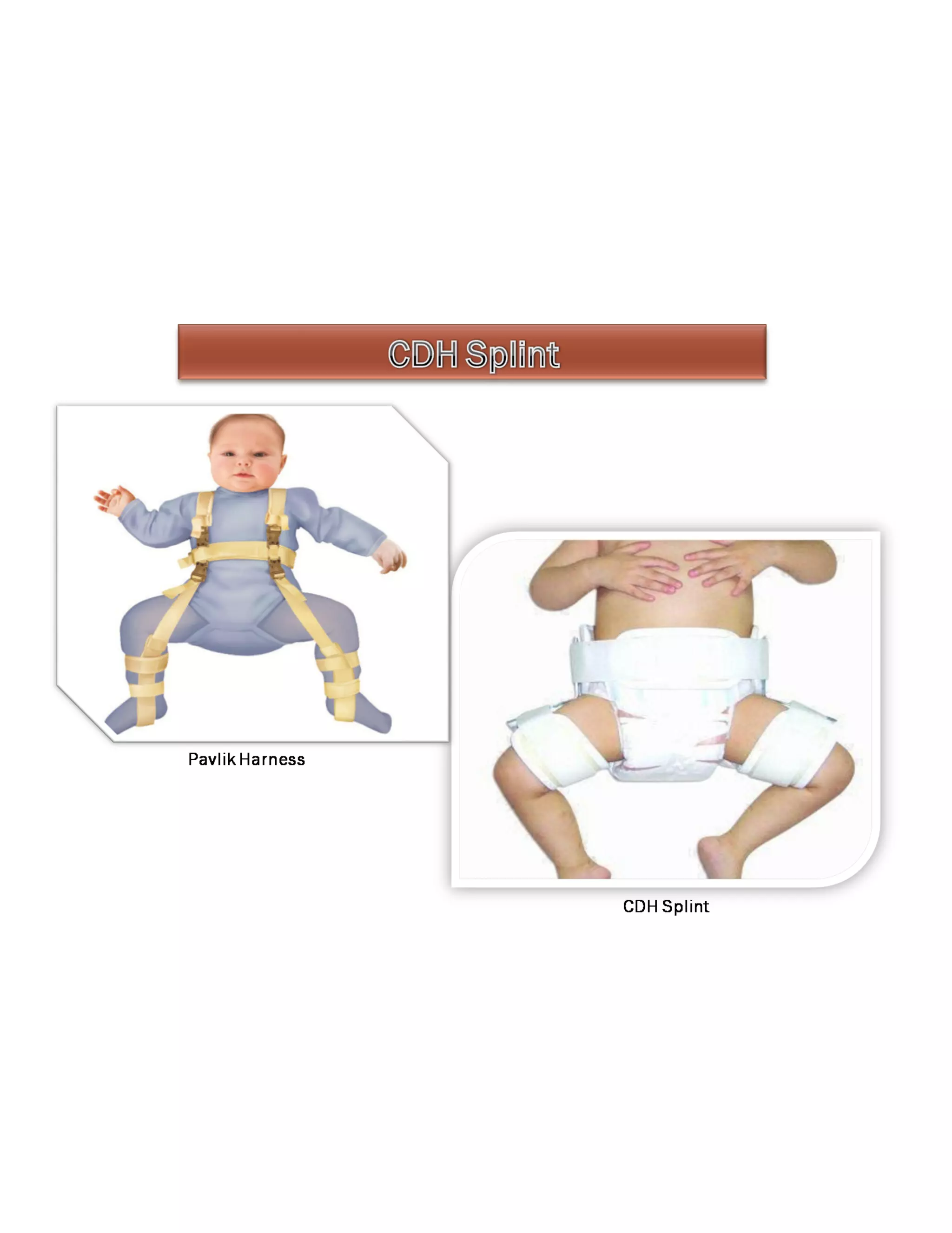 Creative orthotic and prosthetic solutions product catalogue | PDF