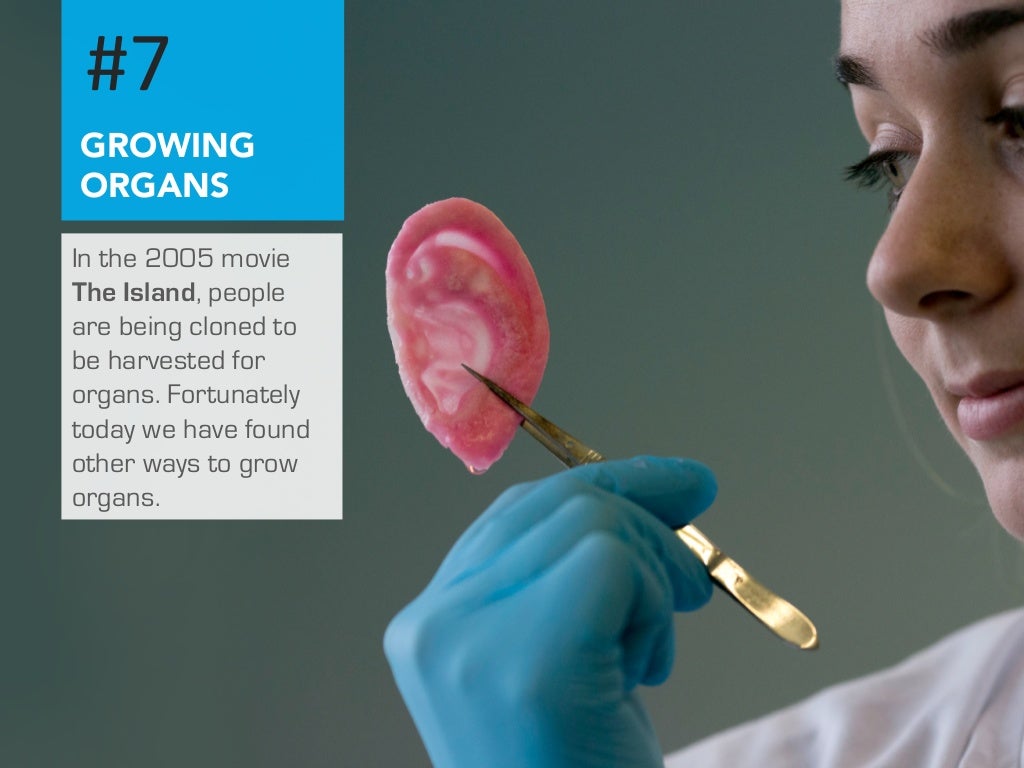 #7 GROWING ORGANS In the