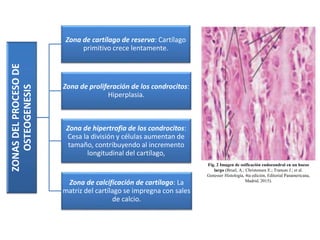 CRECIMIENTO_LONGITUDINAL_DE_LOS_HUESOS_L [Autoguardado].pptx
