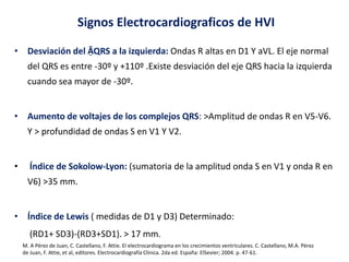 Crecimiento Ventricular | PPTX