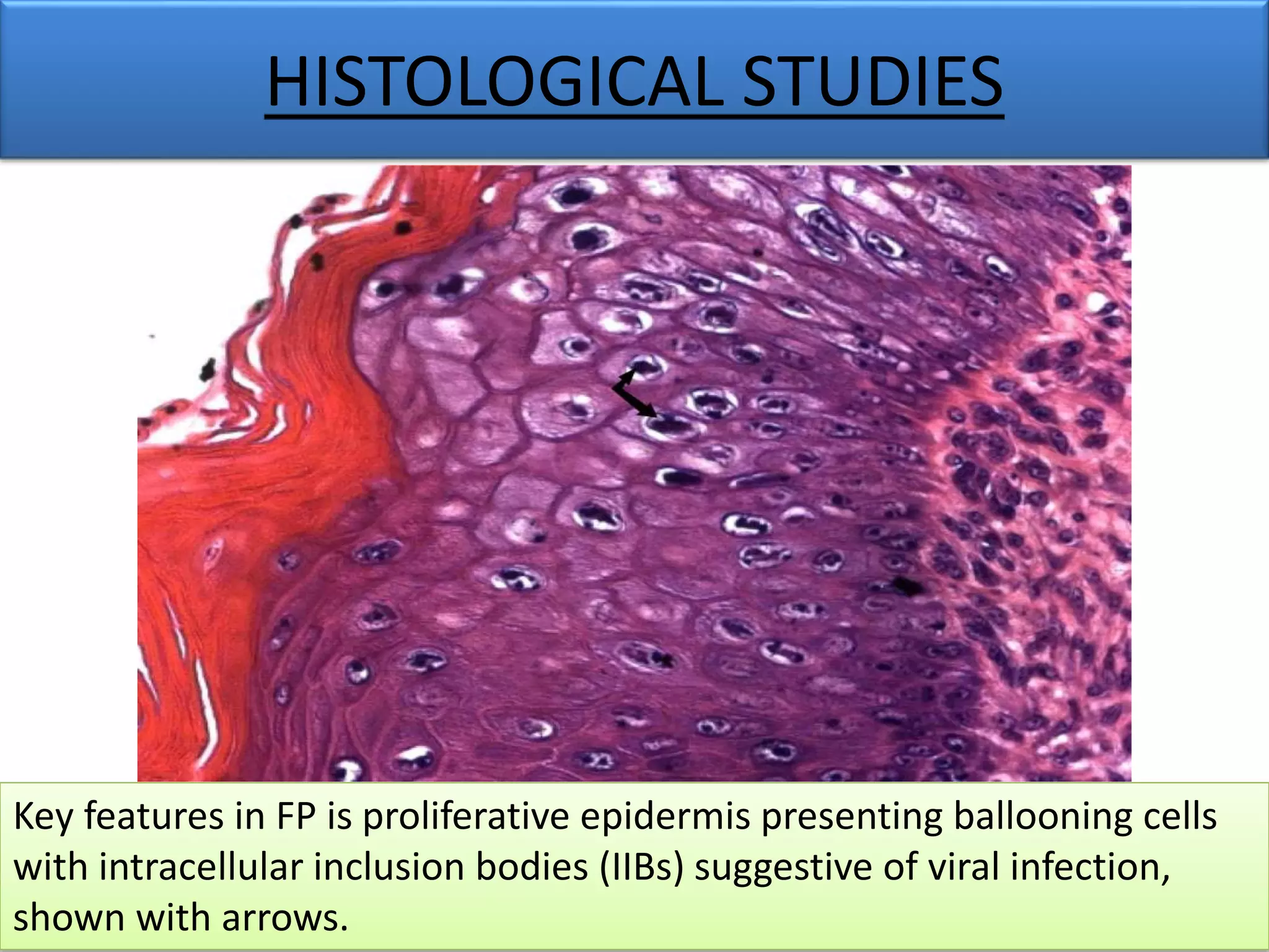 AN OUTLINE ON HERPESVIRAL DISEASES IN MARINE TURTLES | PPTX