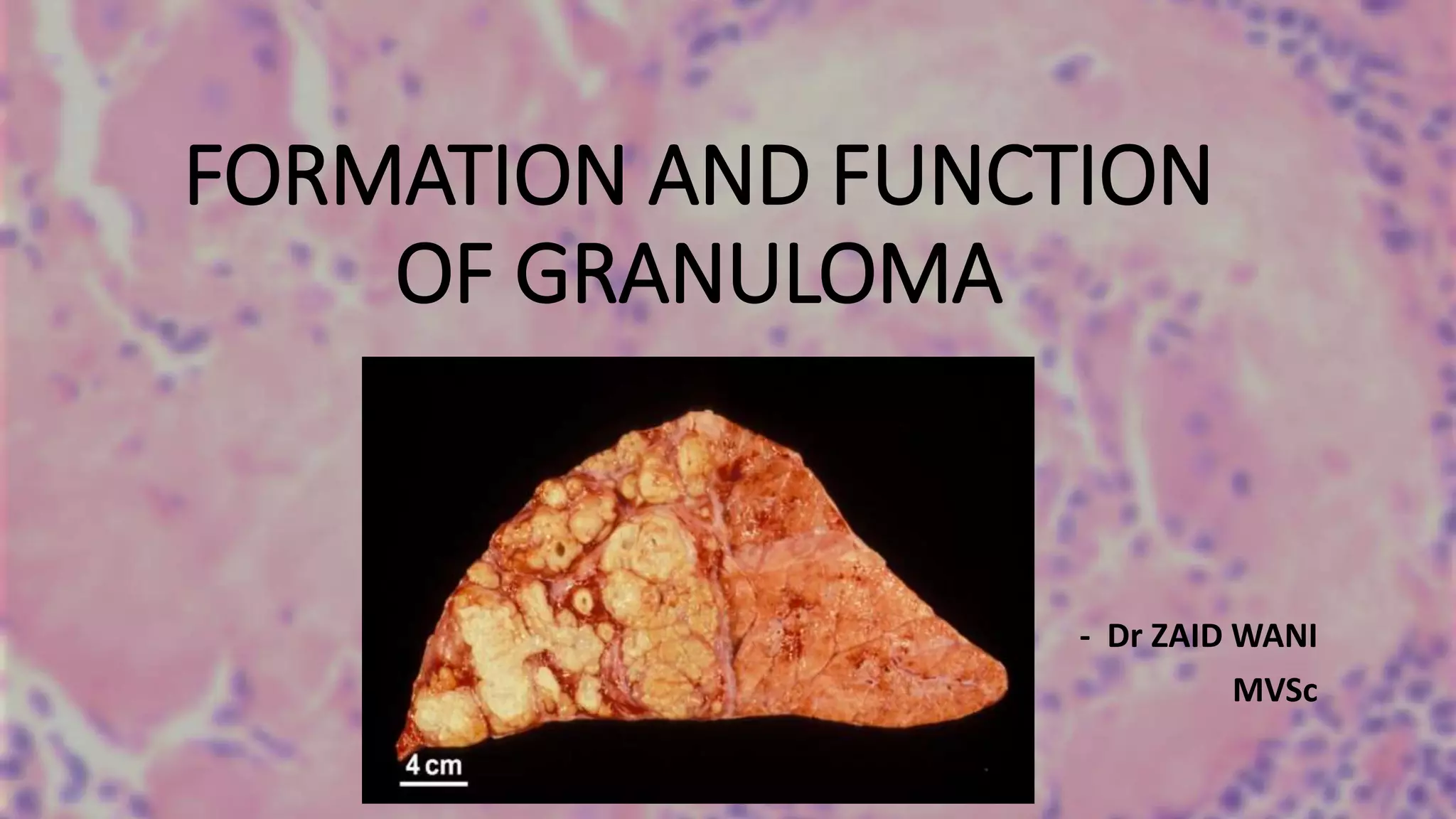 The Formation and Function of Granuloma | PPTX