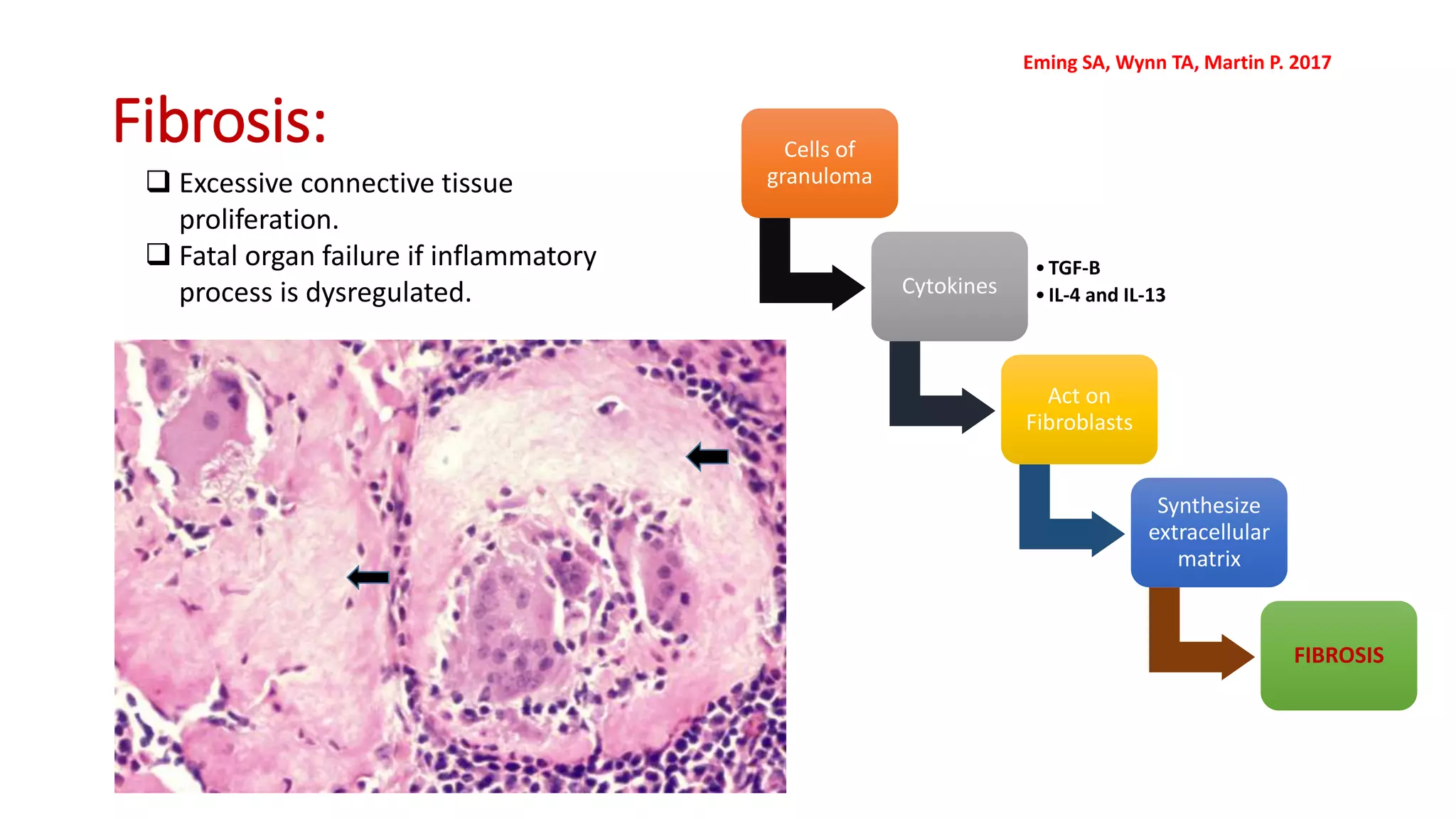 The Formation and Function of Granuloma | PPTX
