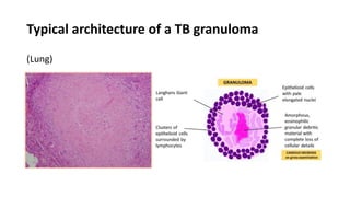 The Formation and Function of Granuloma | PPTX