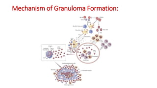 The Formation and Function of Granuloma | PPTX