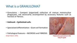Granuloma Fibrosis