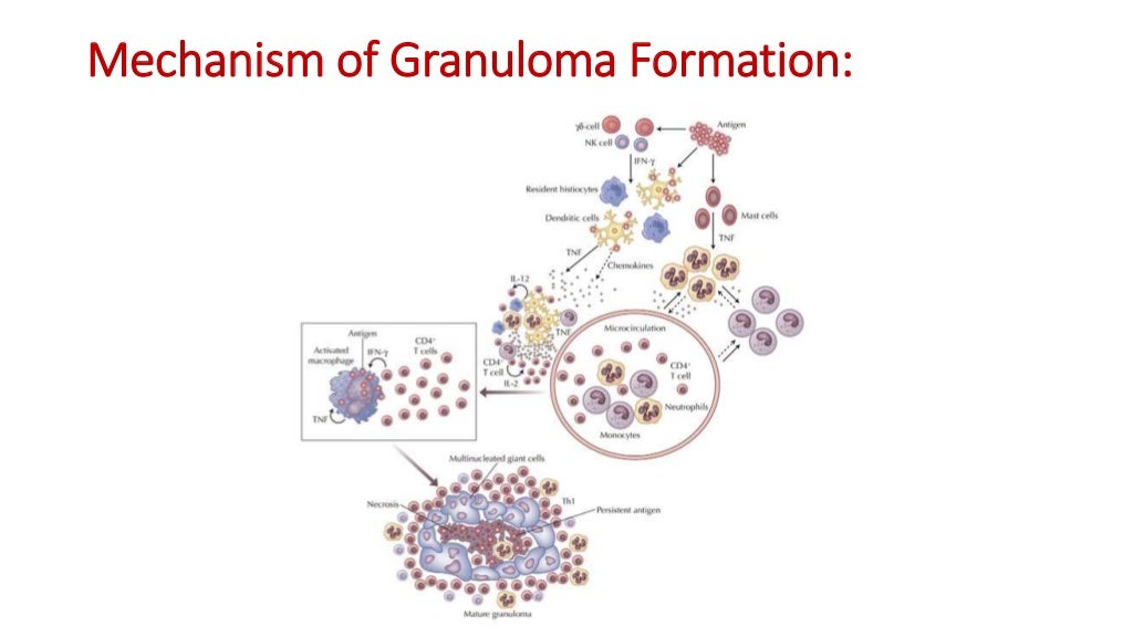 The Formation and Function of Granuloma