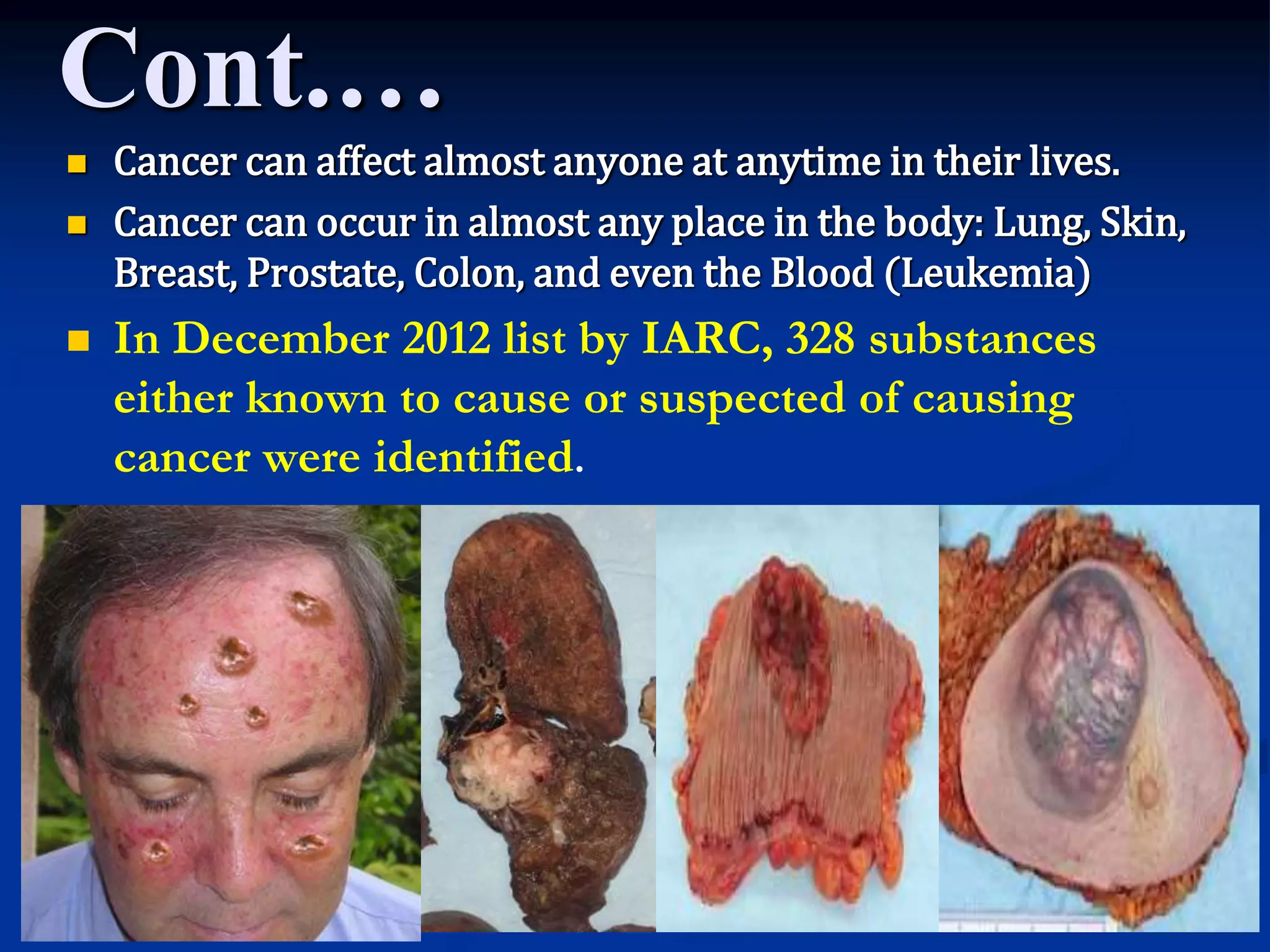 Carcinogenicity in Relation to Environmental Pollution | PPTX