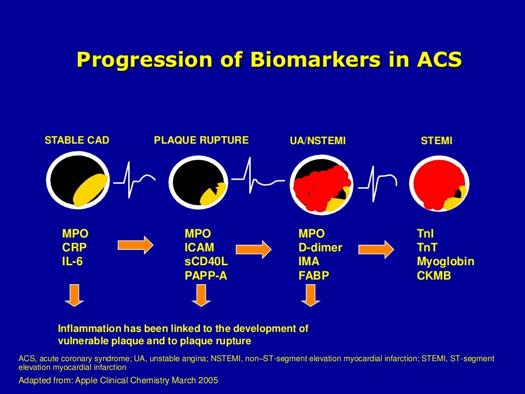 Cardiac biomarkers