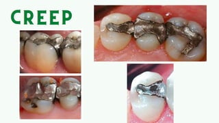 Amalgam Creeps and Marginal Breakdown | PDF