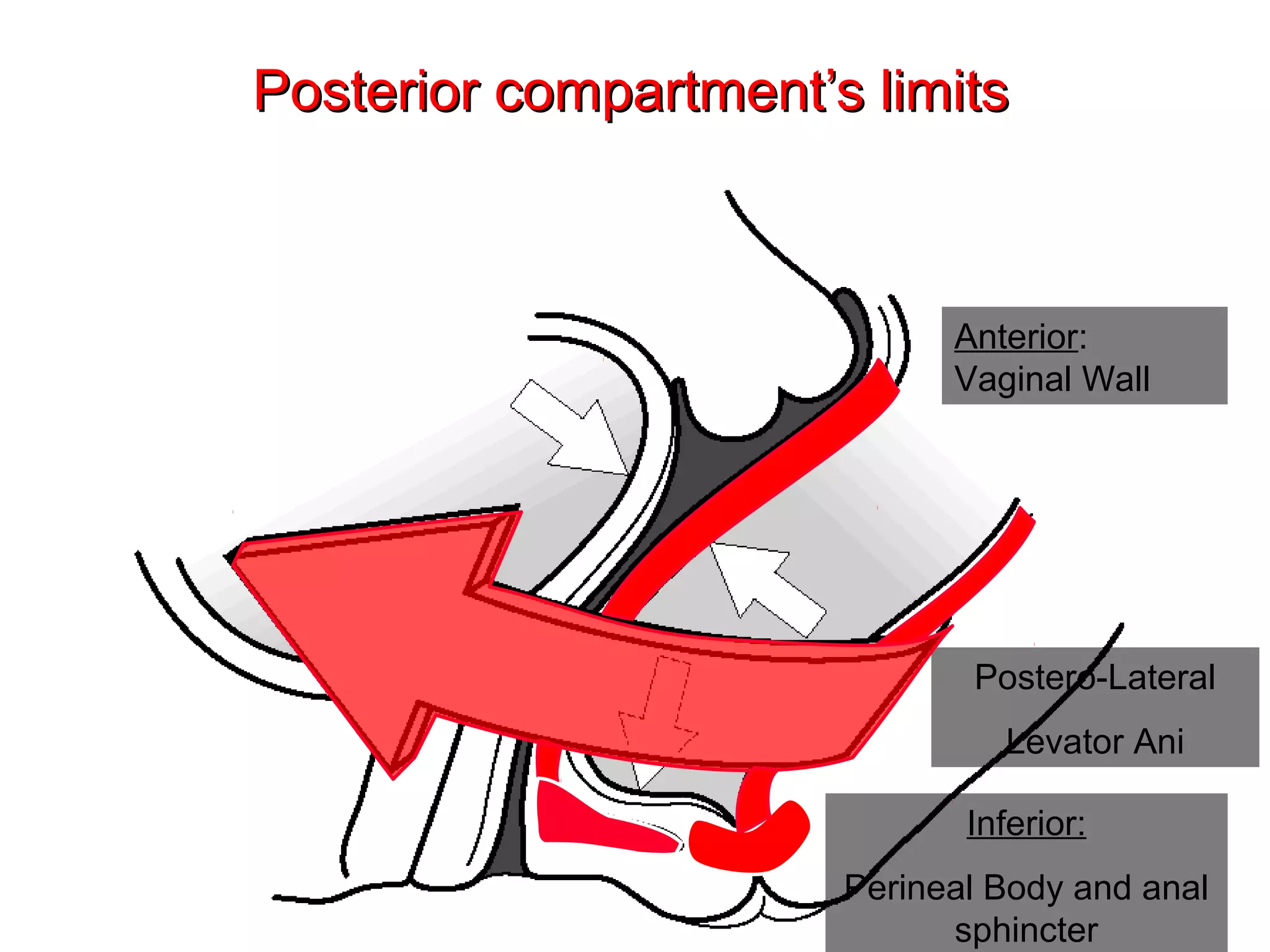 Posterior defect surgery (principles and techniques) - R. Milani/ M ...