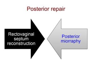 Posterior defect surgery (principles and techniques) - R. Milani/ M ...