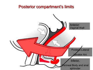 Posterior defect surgery (principles and techniques) - R. Milani/ M ...