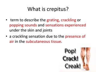 Crepitus | PPT