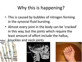 Crepitus | PPT