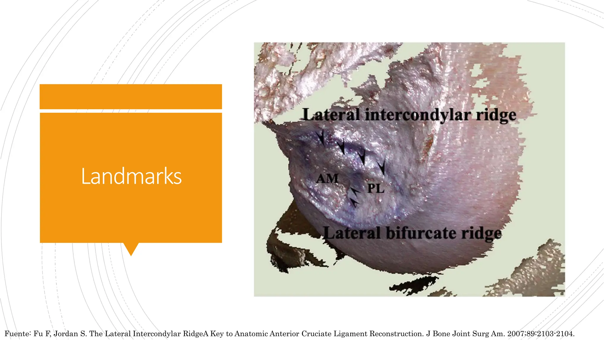 Cresta intercondilar lateral - Ligamento cruzado anterior | PPT