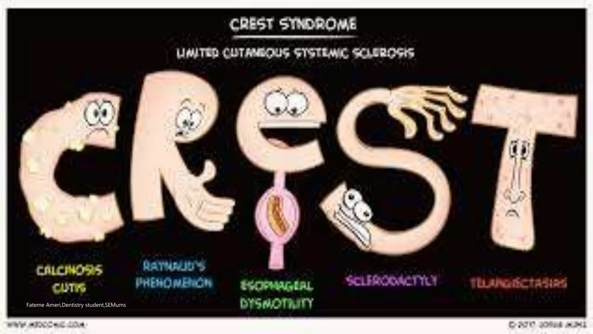 Crest syndrome | PPT