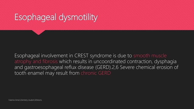 Crest syndrome | PPTX
