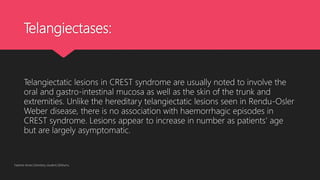 Crest syndrome | PPTX
