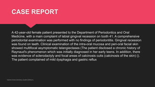 Crest syndrome | PPTX