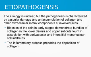 CREST Syndrome | PDF