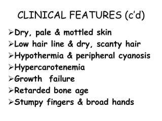 Cretinism & hypothyroidism in children | PPTX