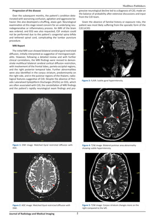 creutzfeldt-jakob-disease-CJD-a-case-report-and-the-role-of ...