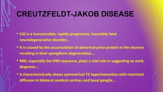 creutzfeldt-jakobdisease-160511045910 (1).pptx