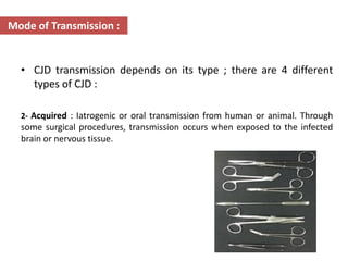 Creutzfeldt jakob disease (cjd) | PDF