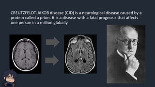 Creutzfeldt jakob | PPTX