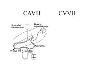 Crf ppt with explanation and details ppt | PPT