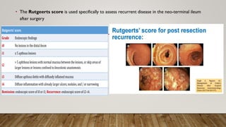 crhons disease BSG-1.pdf | Digestive Disorders | Diseases and Conditions