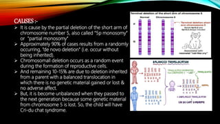 Cri-du-chat syndrome by Herojit.pptx