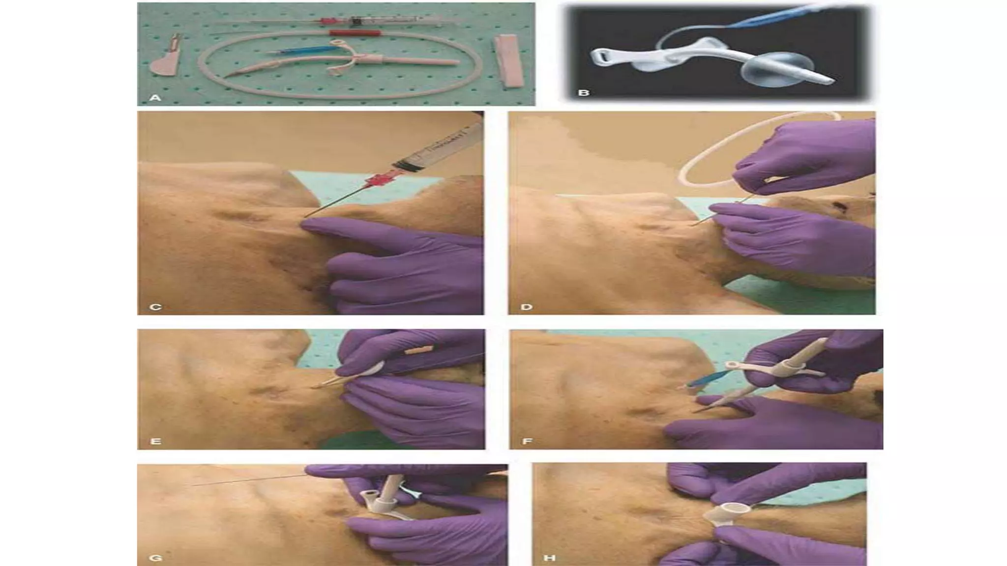 Cricothyroidotomy | PPTX