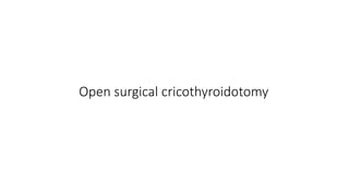 Cricothyroidotomy | PPTX