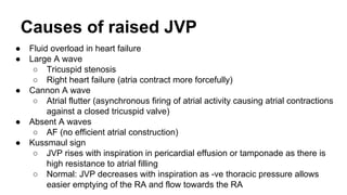 Heart sounds, valves and JVP | PDF