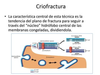 Criofractura | PPTX