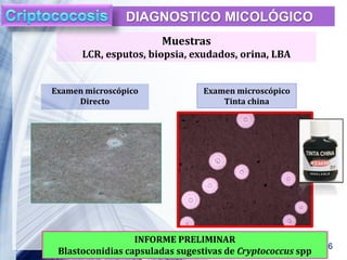 Criptococosis e Histoplasmosis. | PPTX
