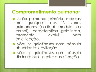 Criptococose pulmonar | PPTX