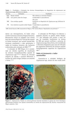 Criptococose pulmonar sbpt 2009 | PDF