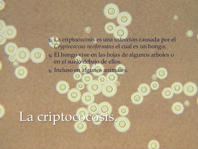 Criptococosis