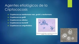 Criptococosis | PPTX