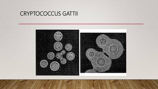 Criptococosis | PPTX