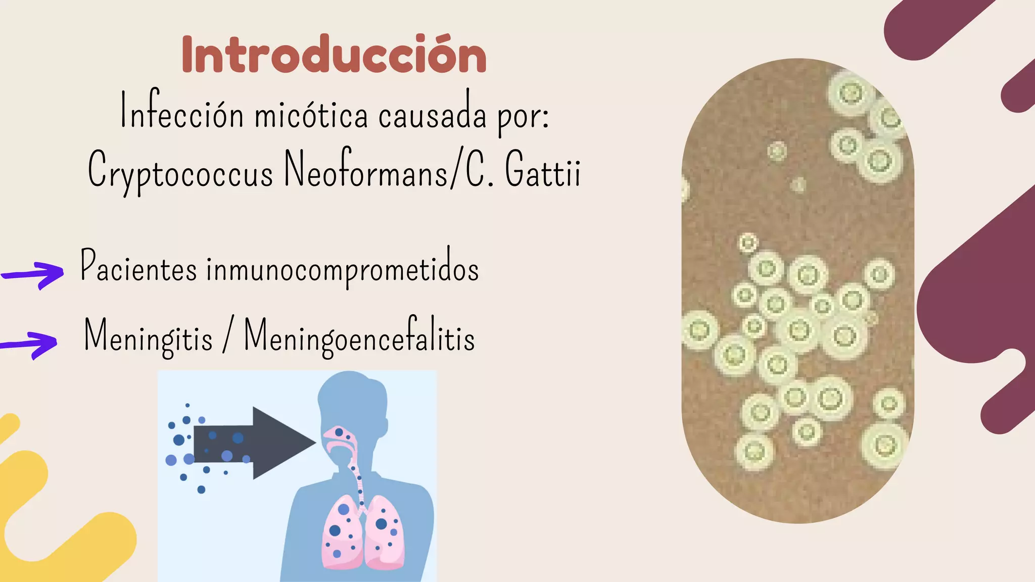Criptococosis.pdf
